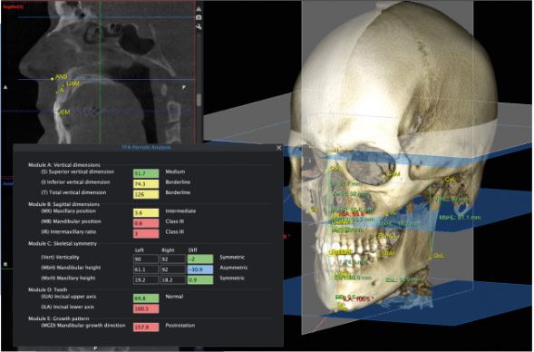 New software releases | Planmeca Romexis