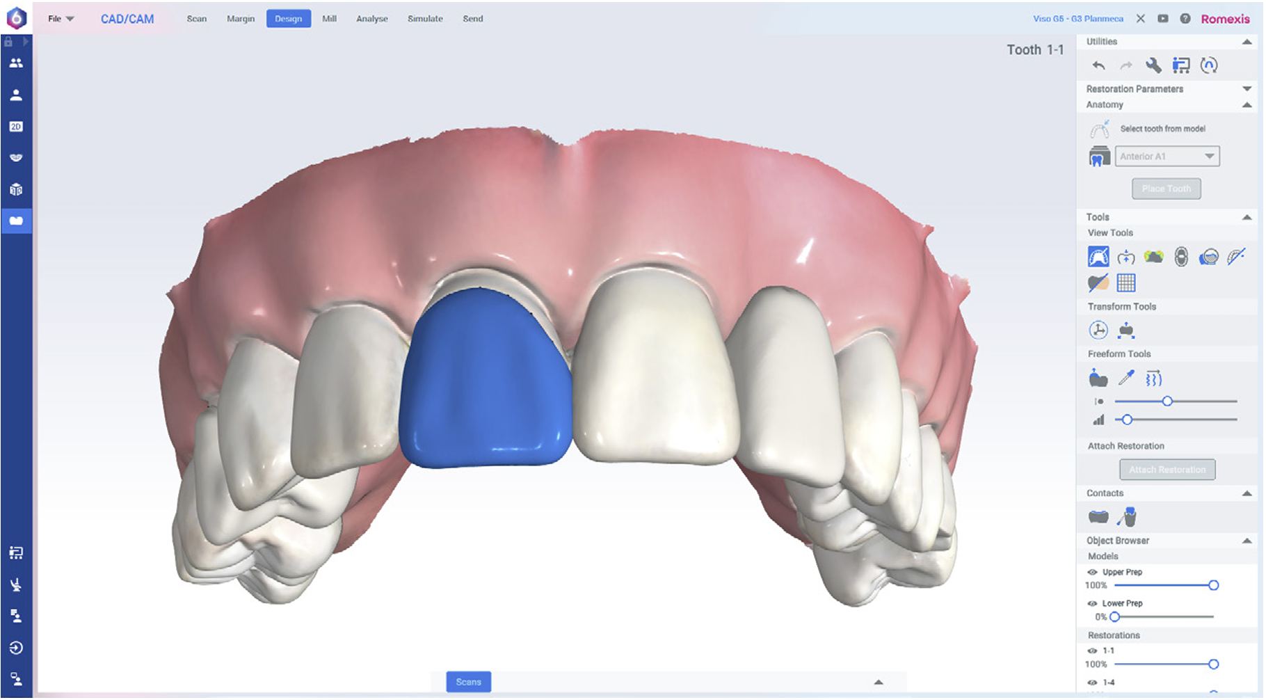New software releases | Planmeca Romexis