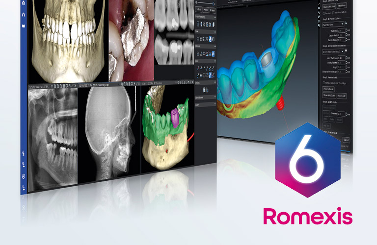 One platform for all treatments | Planmeca