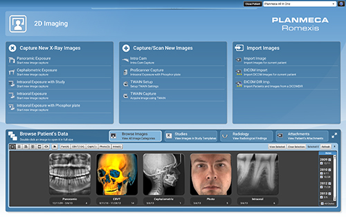 New software releases | Planmeca Romexis