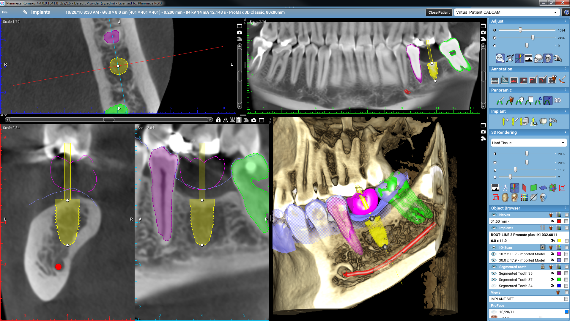 New software releases | Planmeca Romexis