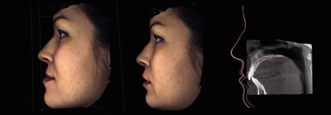 CBCT integrated face photo option | Planmeca ProFace